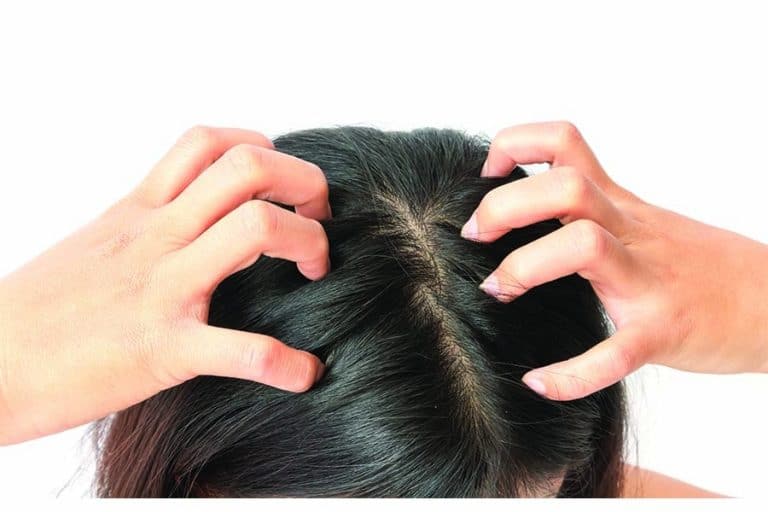 Itchy Scalp: The Common Causes and Treatment to Get Rid of It - We Are ...